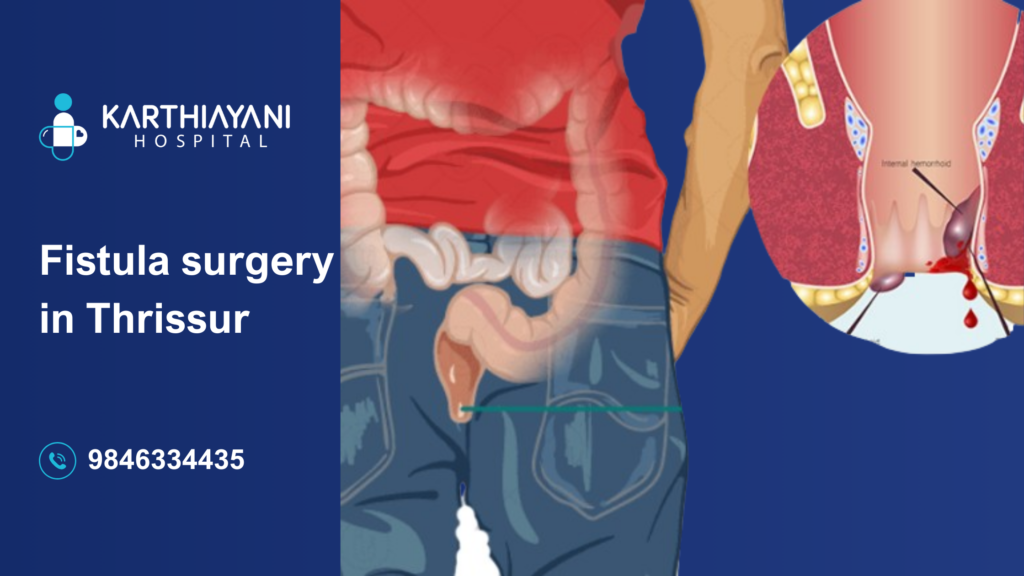 Fistula Surgery in Thrissur - Karthiayani hospital
